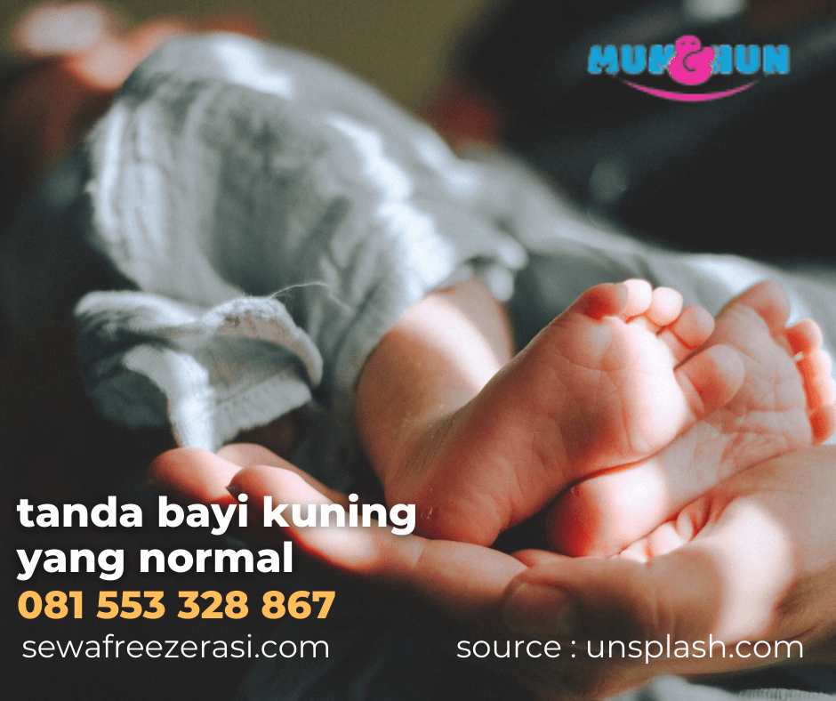 4 Tanda-tanda Bayi Kuning yang Normal dan Umum pada Bayi | Sewa Freezer ASI | Rental | Kulkas ...